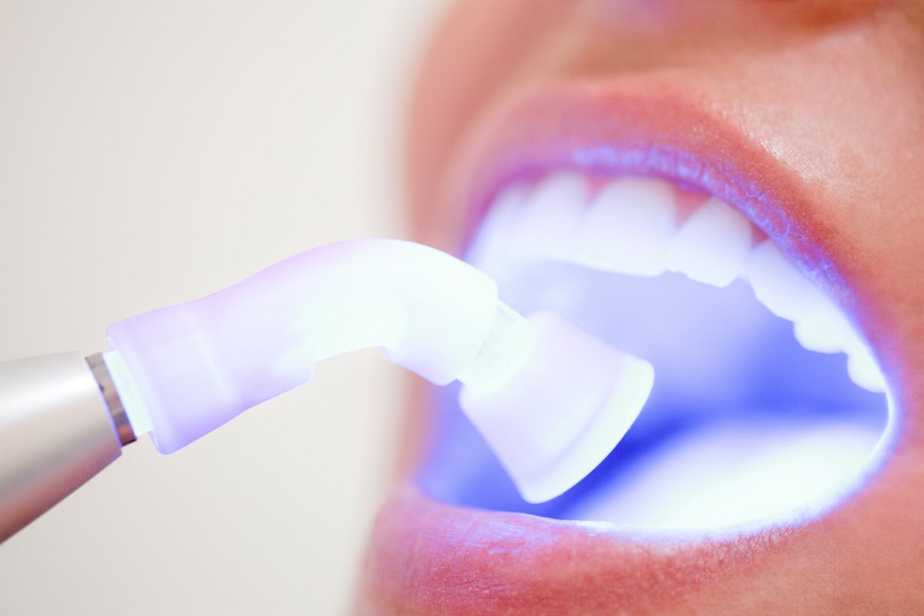 Soft Tissue Laser Winter Dental